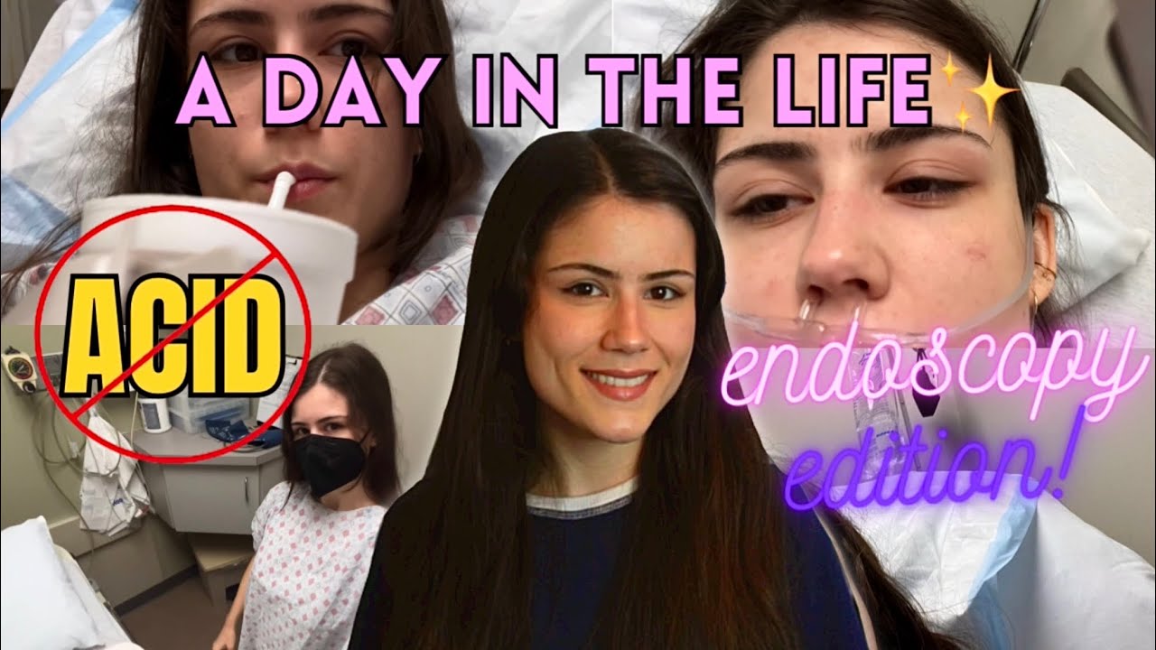 my upper endoscopy/gastroscopy experience for acid reflux (with POTS ...