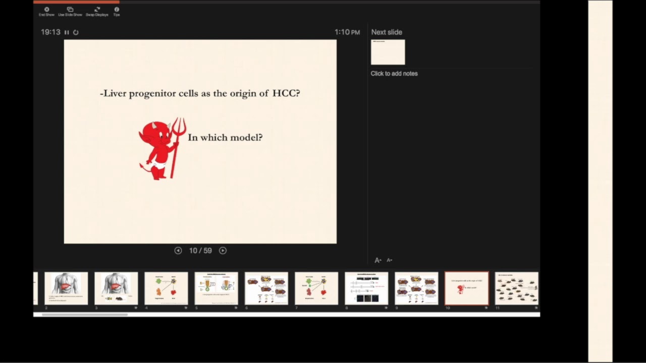 Navigating Liver Cancer Molecular Complexities Using Mouse Models - YouTube