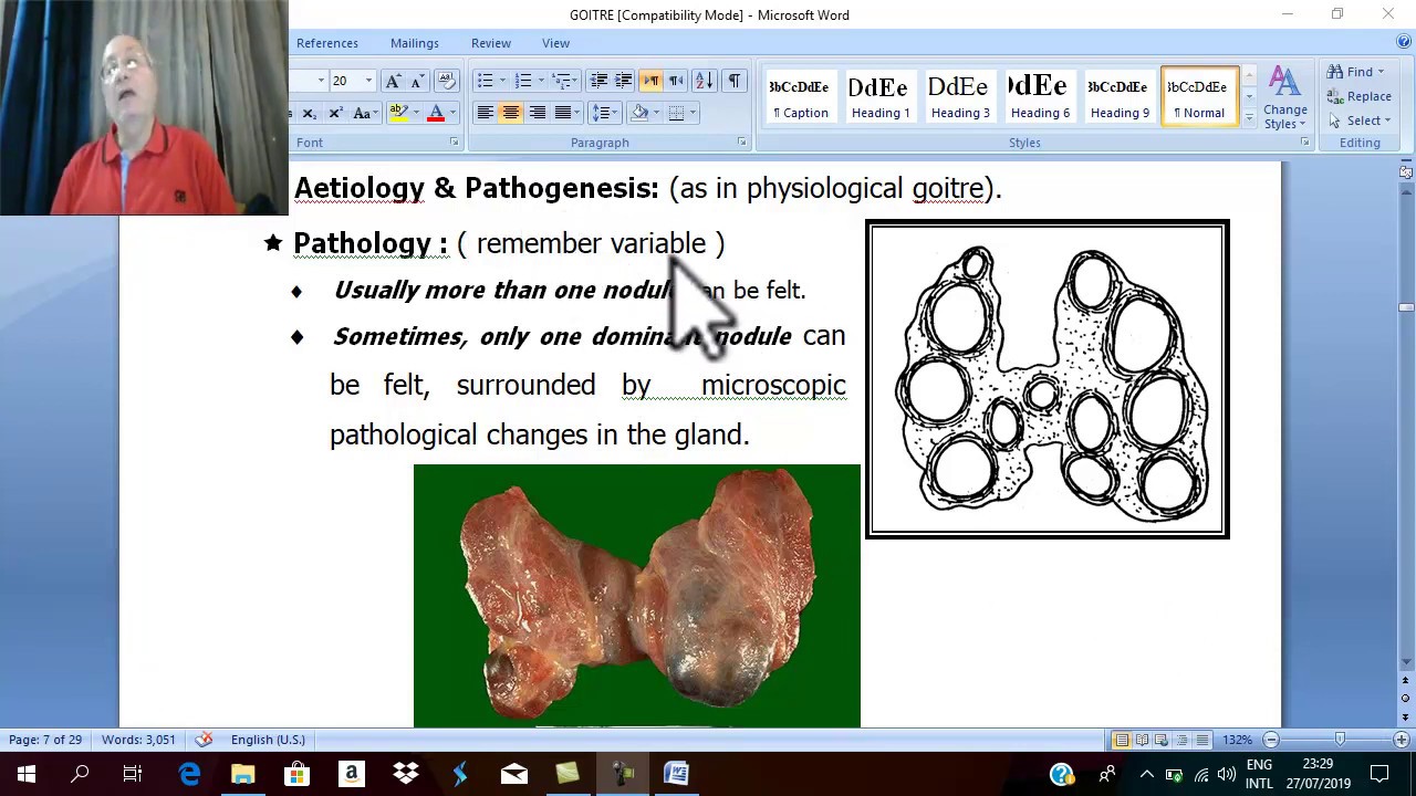 Thyroid Disorders in English 7 (Simple nodular goitre , part 1 ) , by ...