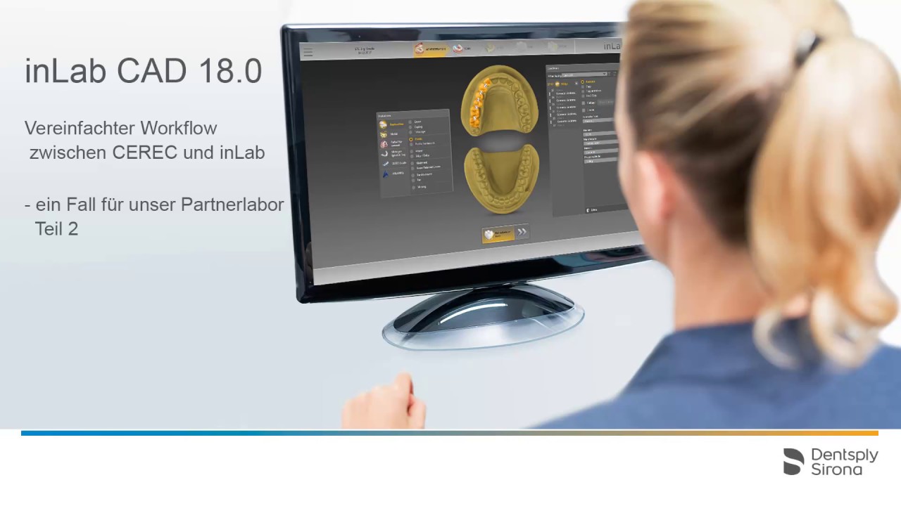 inLab CAD Software 18.0 Vereinfachter Workflow zwischen CEREC und inLab ...