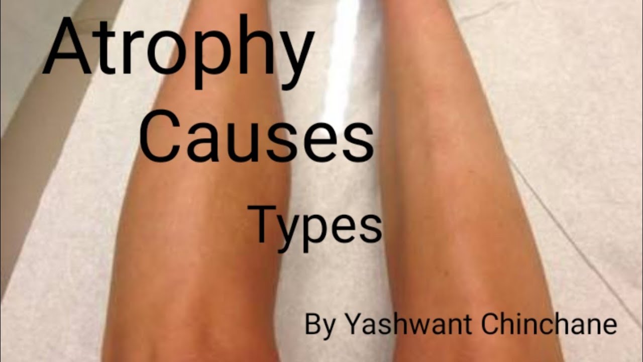 Atrophy| Causes of Atrophy |Morphological features of atrophy| - YouTube