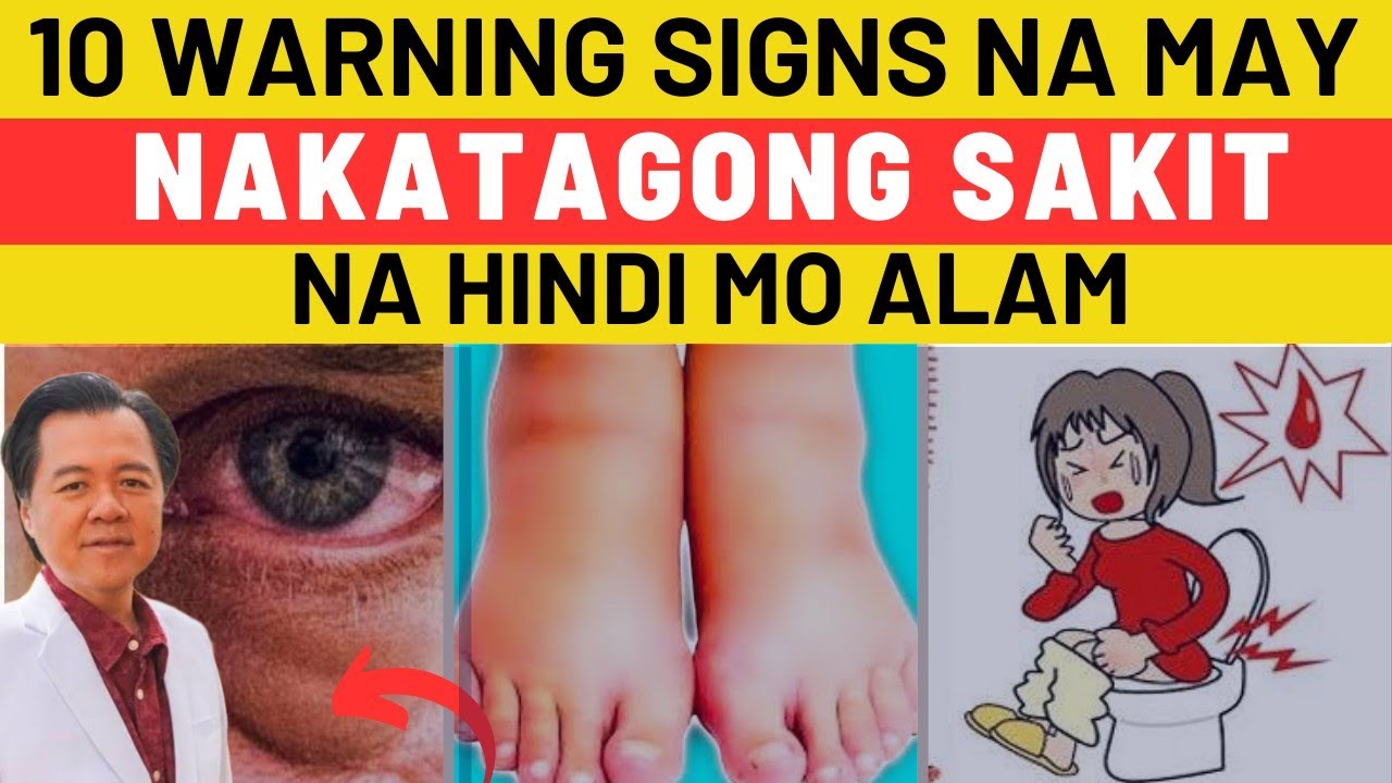 10 Warning Signs na May Nakatagong Sakit Na Hindi Mo Alam - Payo ni Doc ...