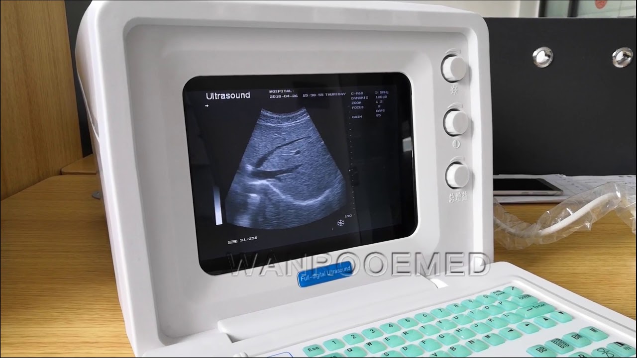 US3101A Hospital Portable Digital Ultrasound Scanner Machine For ...