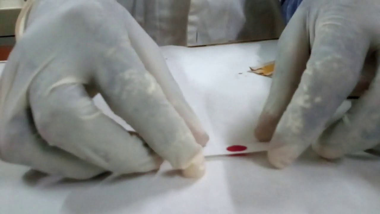 Tallquist method of Hb estimation - YouTube