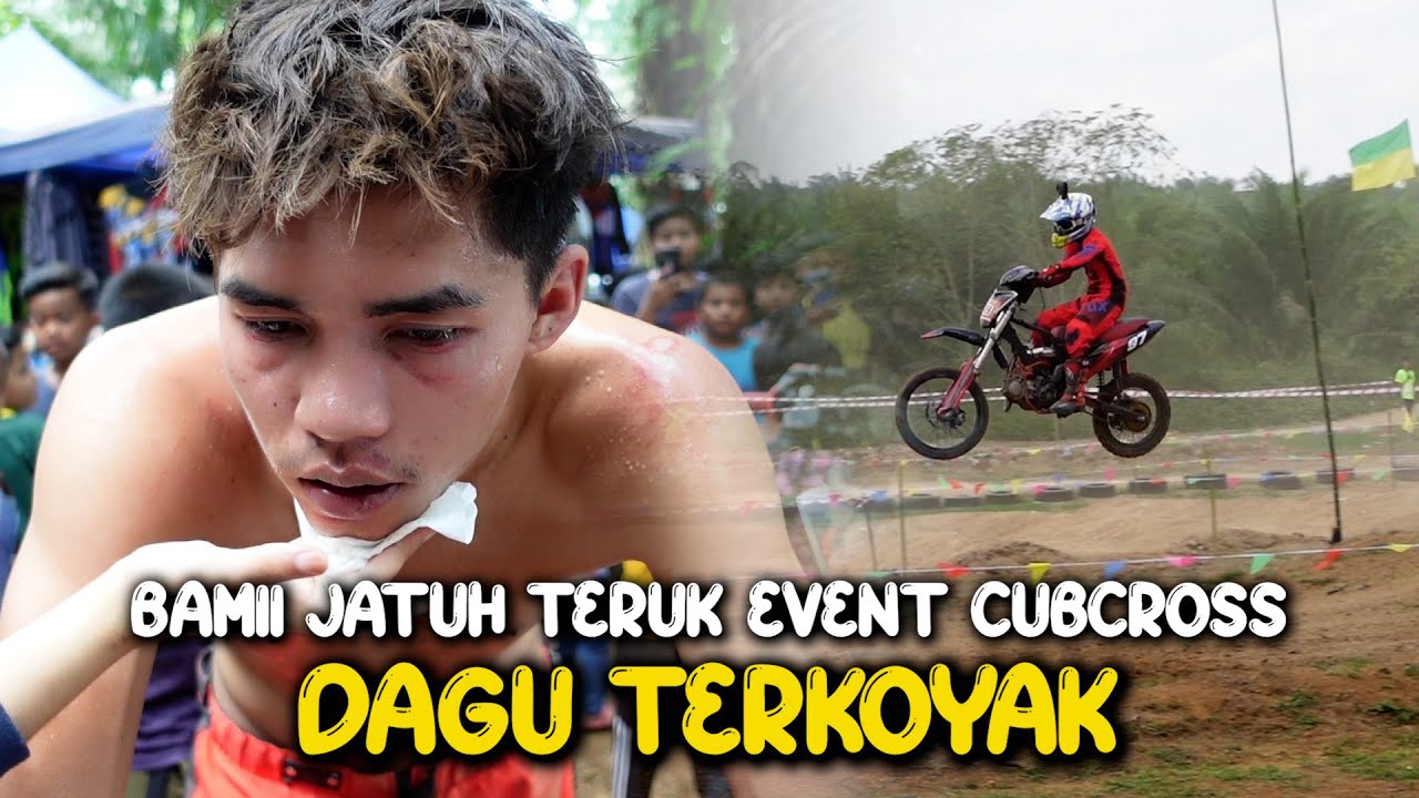 BAMII JATUH TERUK MASA LAWAN CUBCROSS DI PENDANG !! DAGU BAMII TERKOYAK ...