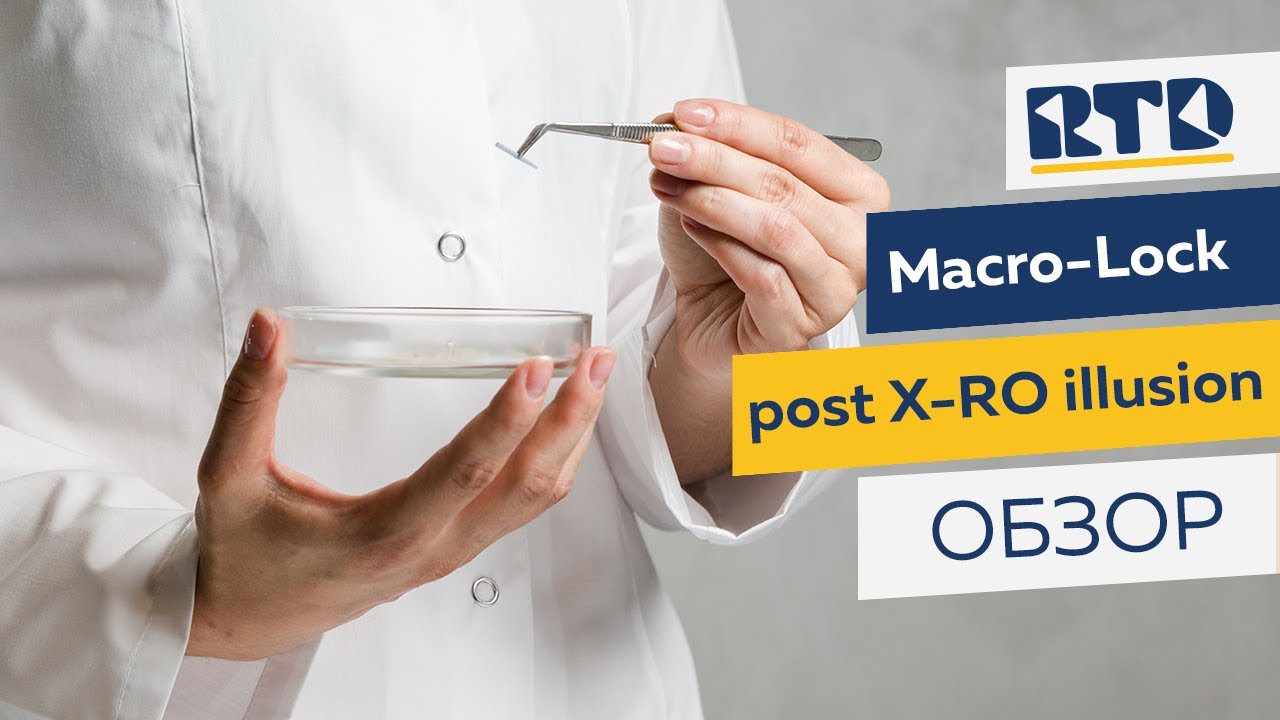 Видеообзор. Стекловолоконные штифты Macro-Lock ILLUSION X-RO от RTD ...