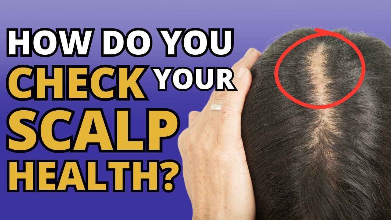 How Do You Check Your Scalp Health? - YouTube