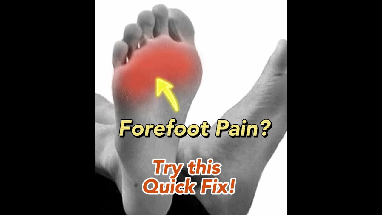 Forefoot Pain Quick Fix!- DIY - YouTube