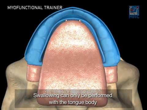 Myofuntional Trainer - YouTube
