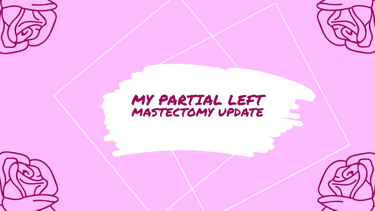 My Partial Left Mastectomy Update - YouTube