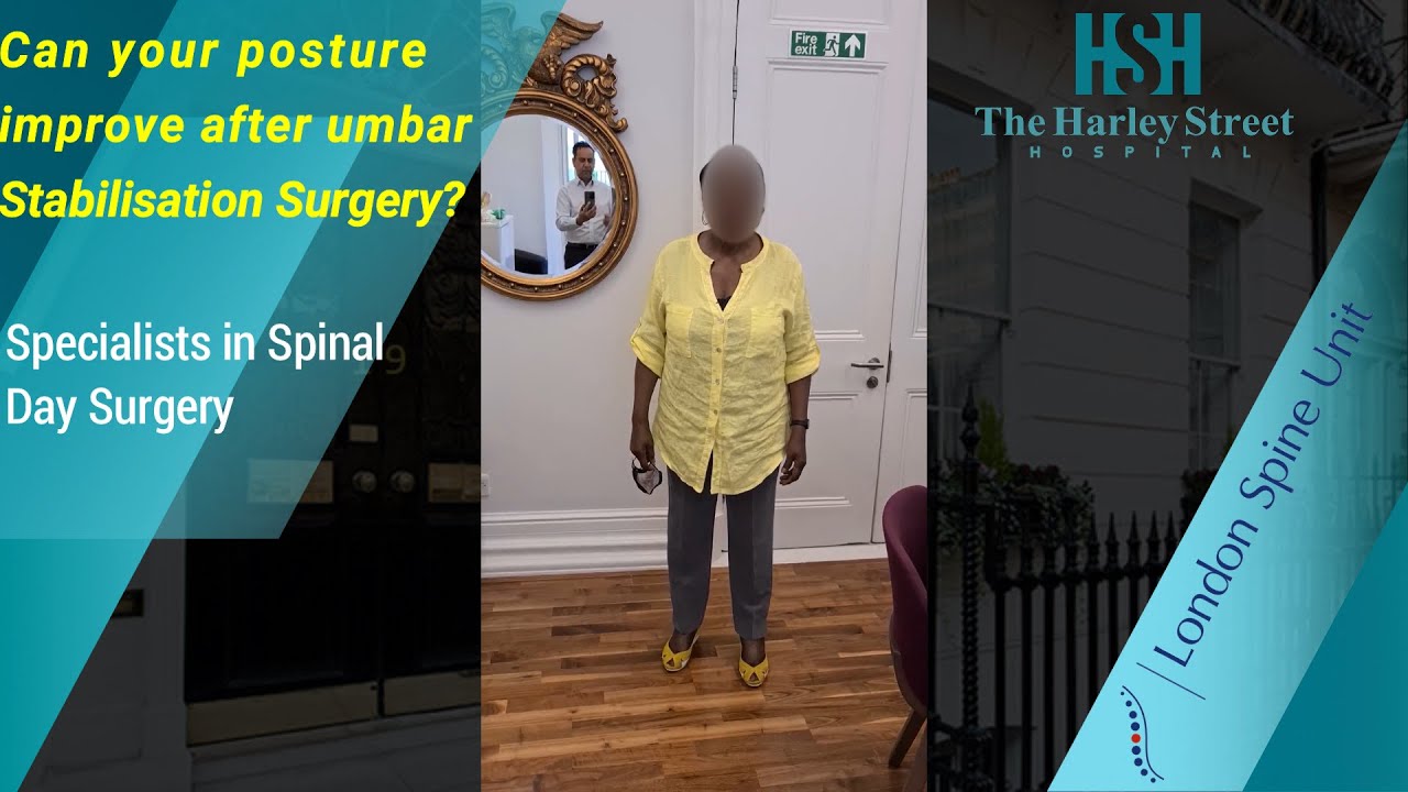 Can your posture improve after Lumbar Stabilisation Surgery ? - YouTube