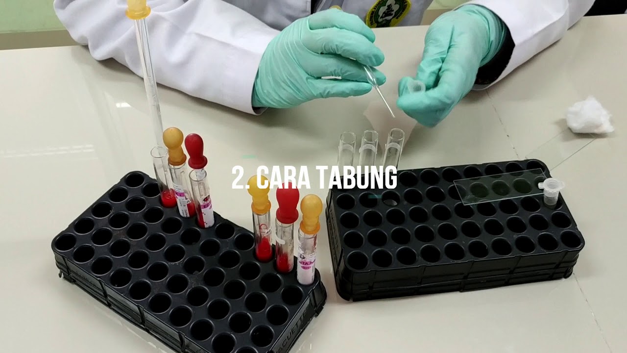 Elfa Nur Hikmah//Pemeriksaan Golongan Darah Metode Reverse Grouping ...