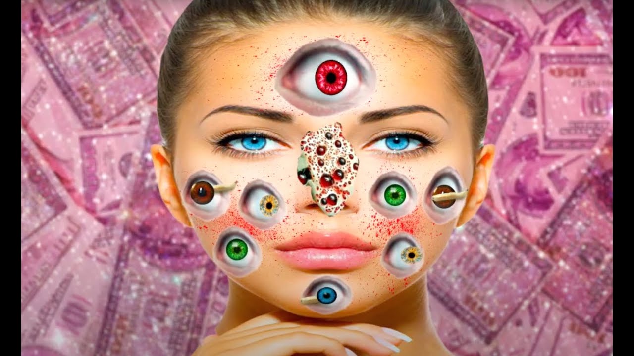 ASMR Treatment Remove Parasitic Eyes & Maggot on Face | ASMR ...