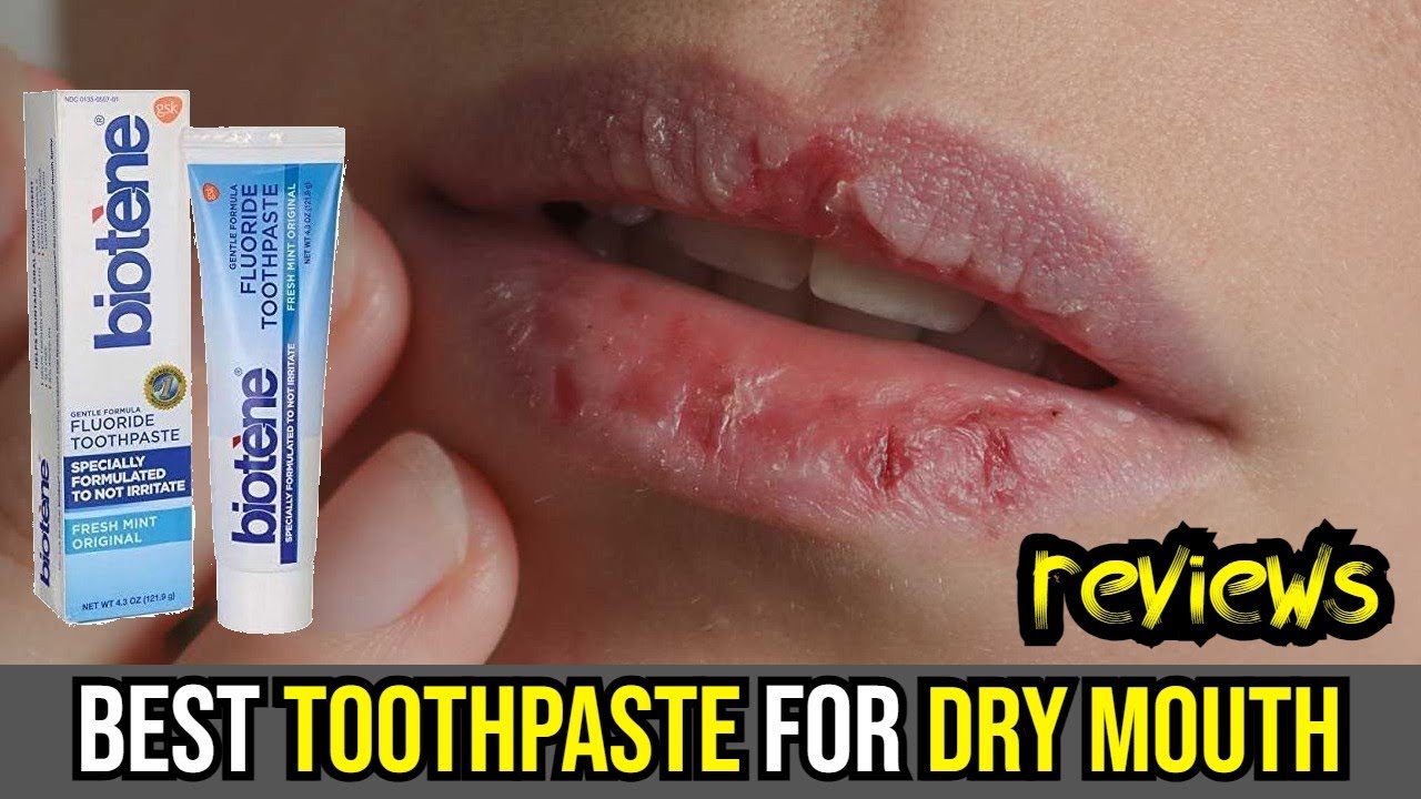 🌟 Ultimate Relief for Dry Mouth! Top 3 Toothpaste Reviews | Fresh ...
