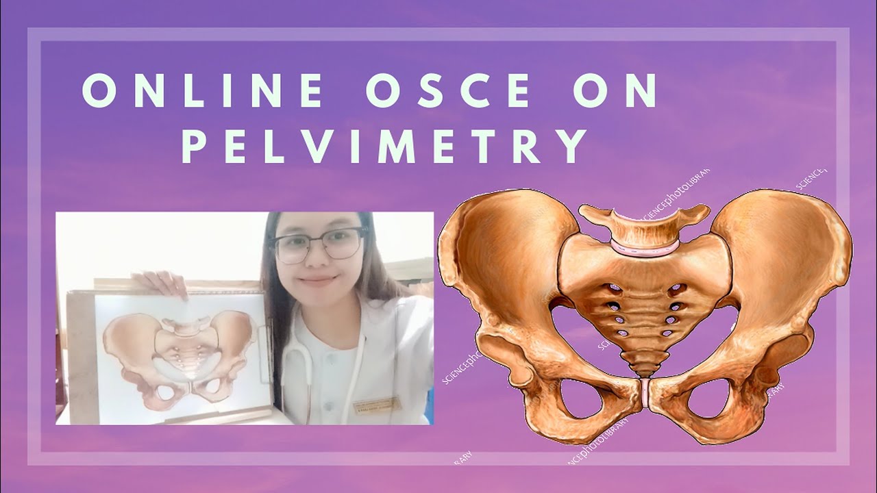 Online OSCE on Clinical Pelvimetry - YouTube