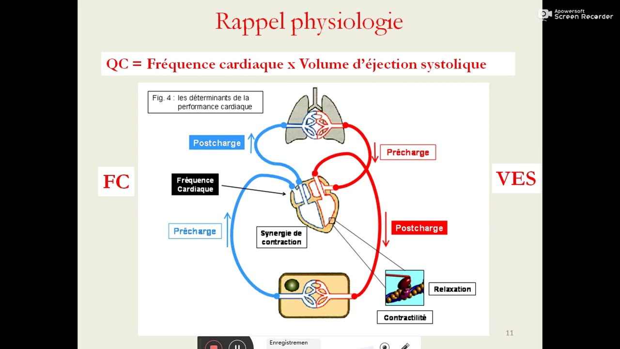 Insuffisance cardiaque droite - YouTube