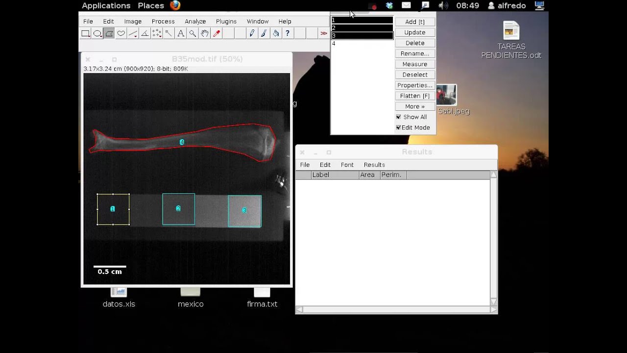 3d Roi Manager Imagej Documentation Wiki