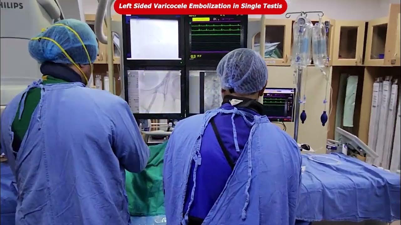 Left Sided Varicocele Embolization In Single Testis Irfacilities
