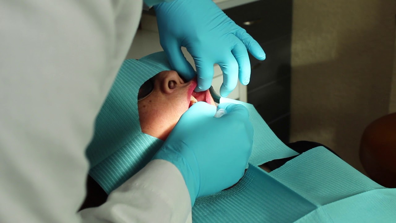 Dental Stem Cell Therapy - YouTube