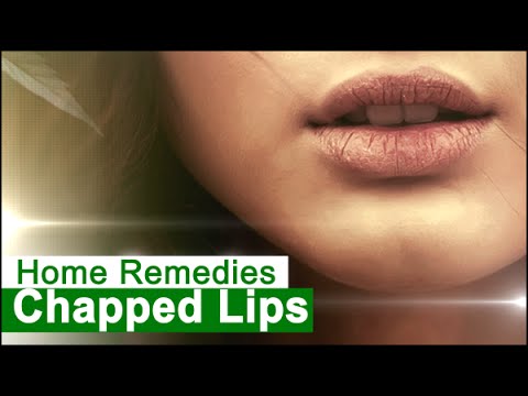 Home Remedies for Chapped lips | How to get rid of dry and chapped lips ...
