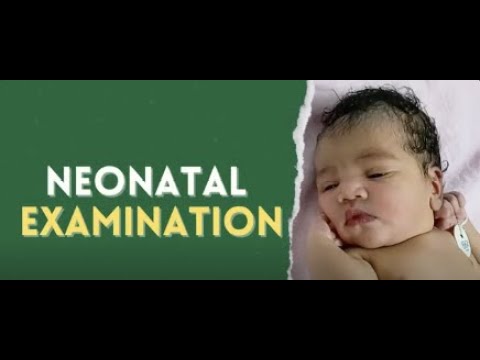Paediatrics Short Case - Neonatal examination - Clinical Exam Revision ...
