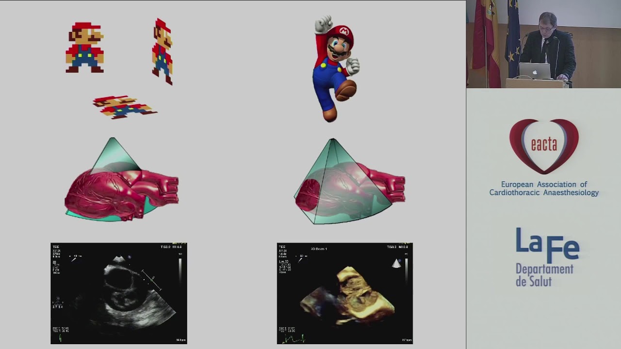 3D TEE: Basic principles. Acquisition and interpretation - YouTube