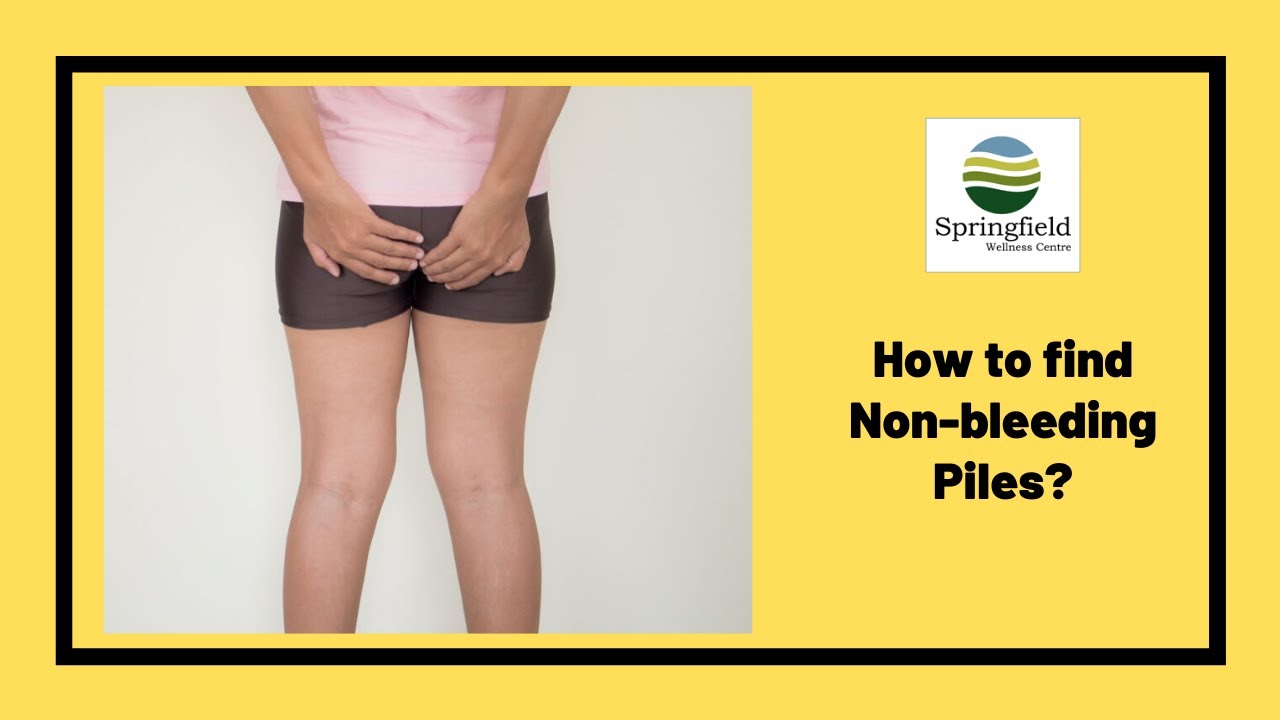 How to find non-bleeding piles? | Dr Maran, Piles Specialist in Chennai ...