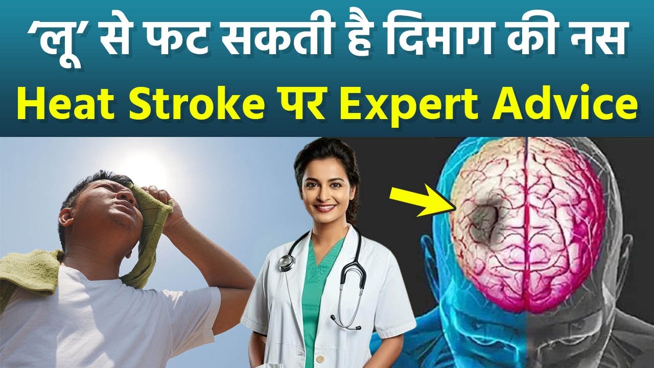 Heat Stroke से Brain Stroke Risk Reason | Heat Stroke Symptoms and ...
