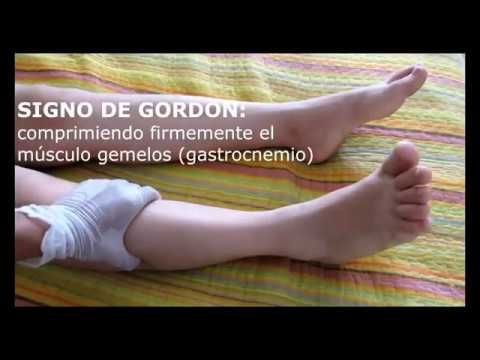 SIGNO DE BABINSKI Y SUCEDÁNEOS - YouTube