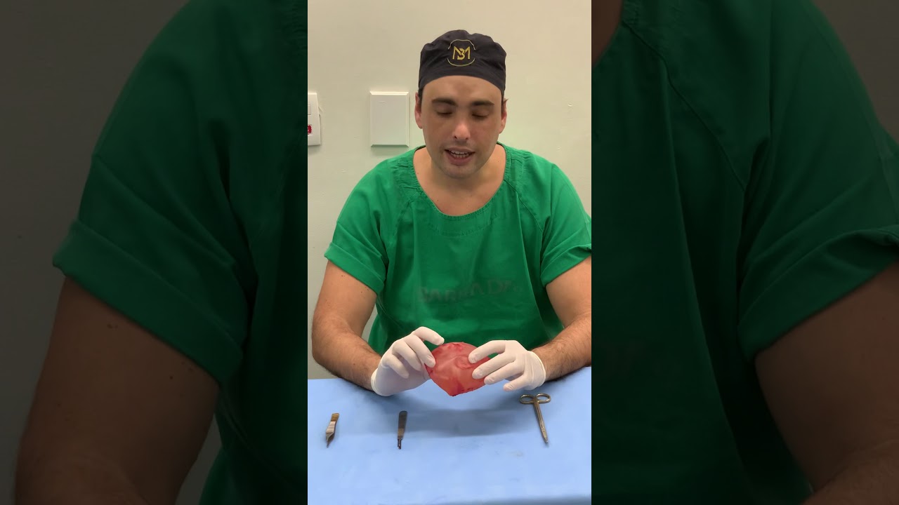 CONTRATURA CAPSULAR - PRÓTESE ENCAPSULADA - YouTube