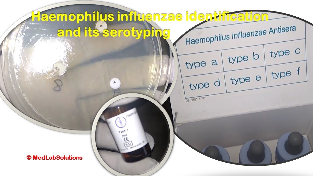 Haemophilus influenzae identification and its serotypes antisera expo ...
