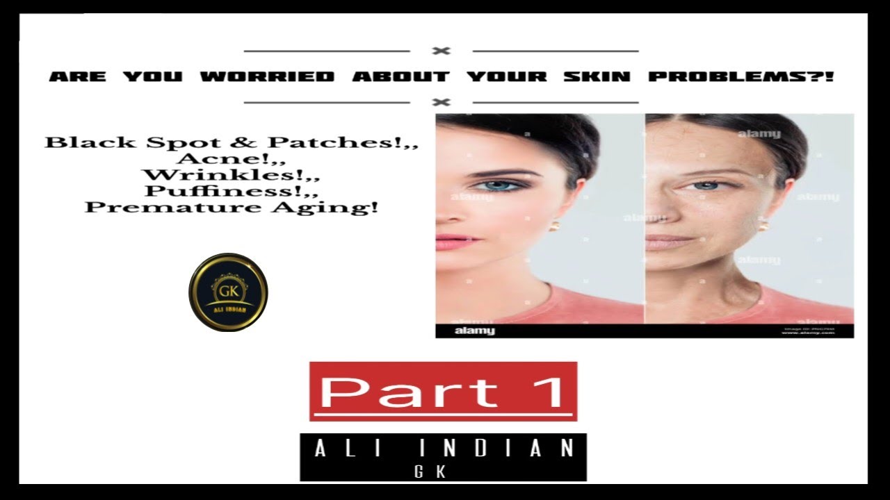 Skin Problems & Solutions ( Part 1) - YouTube