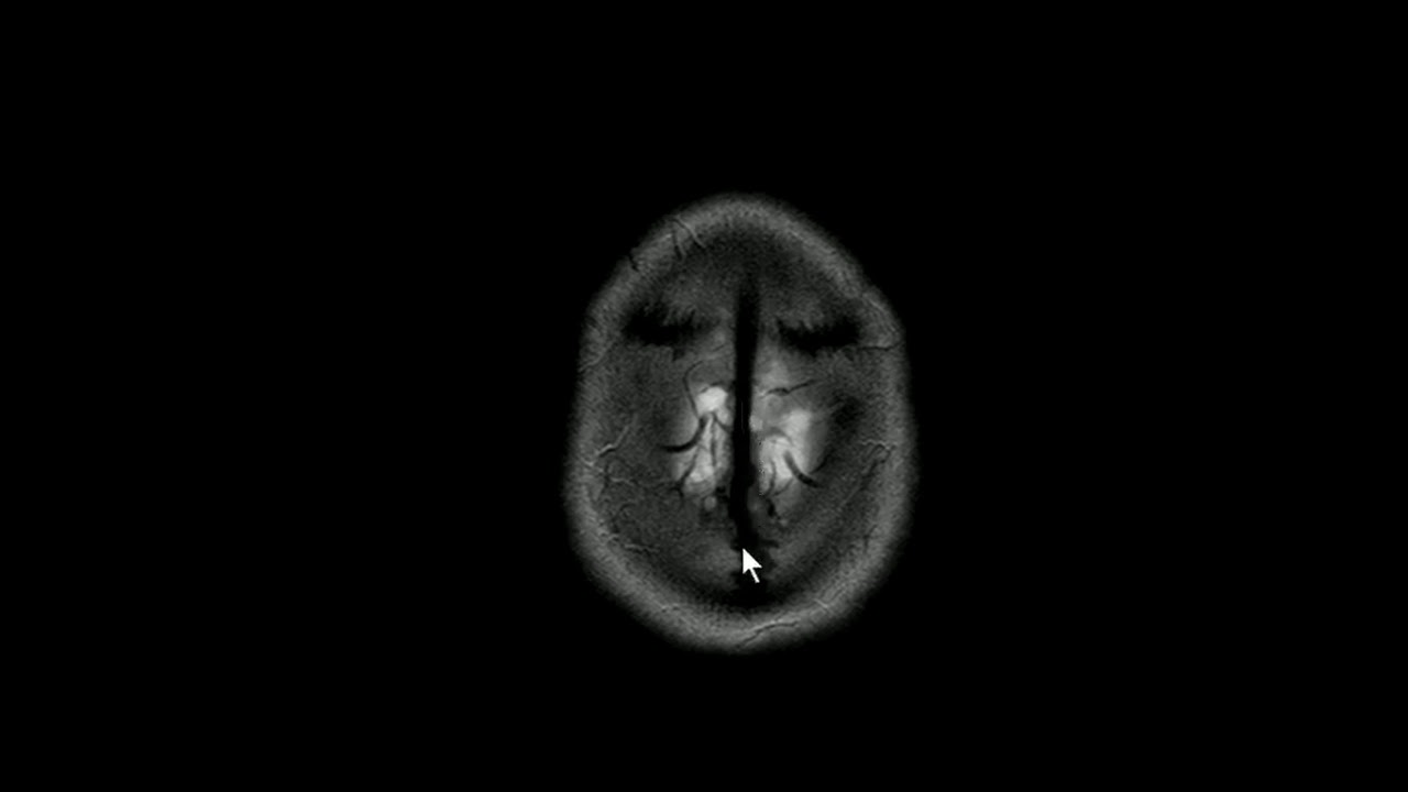 RM crânio ANATOMIA - YouTube