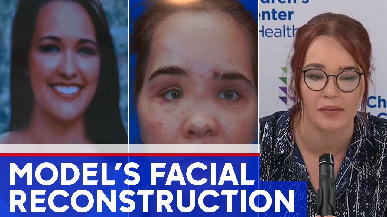 Former model shares message of positivity after face shattered in crash ...