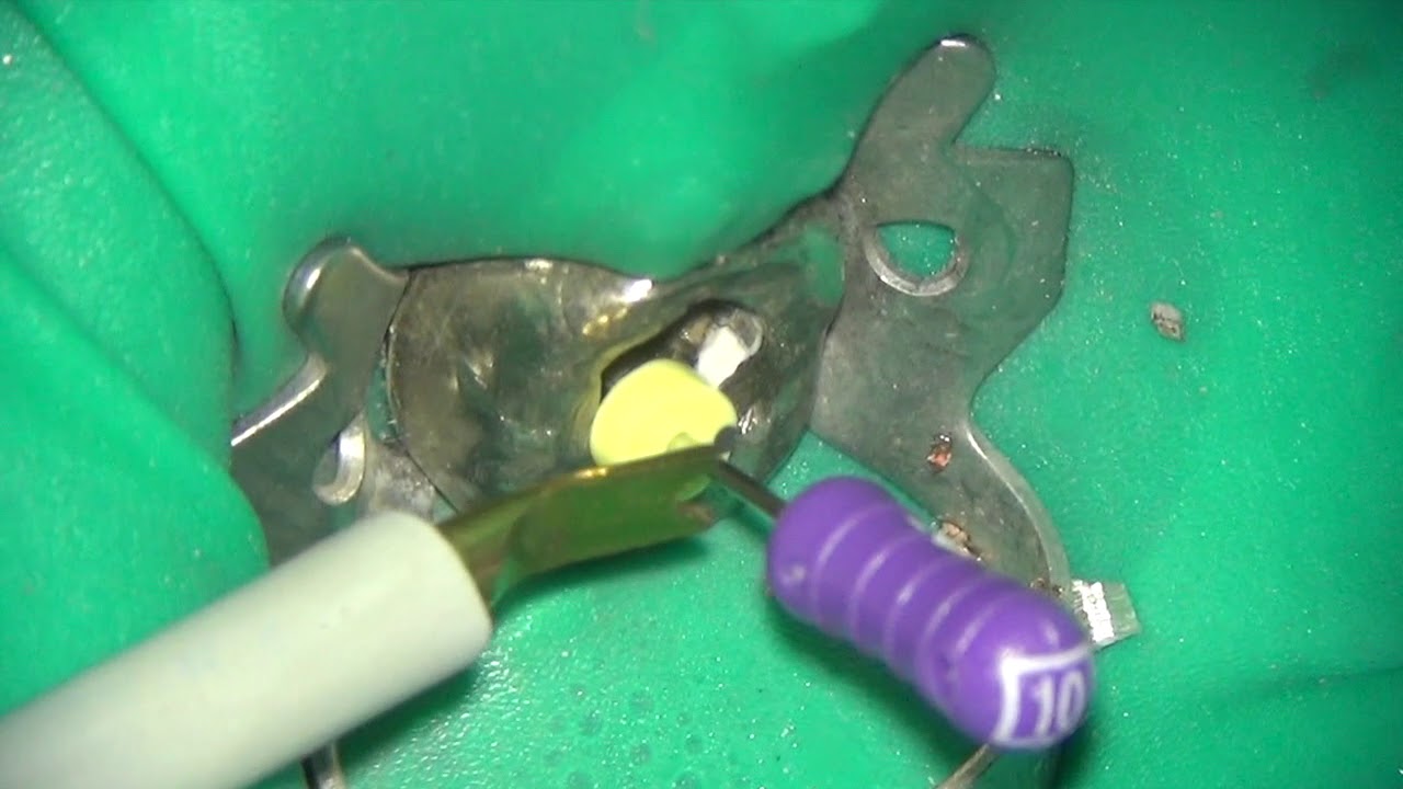 Removing an amalgam Nayyar Core - YouTube