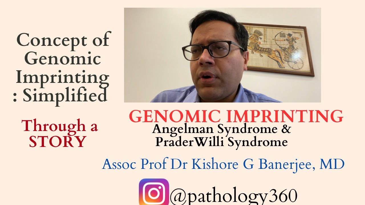 Concept of Genomic Imprinting ; Angelman Syndrome ; Concept explained ...