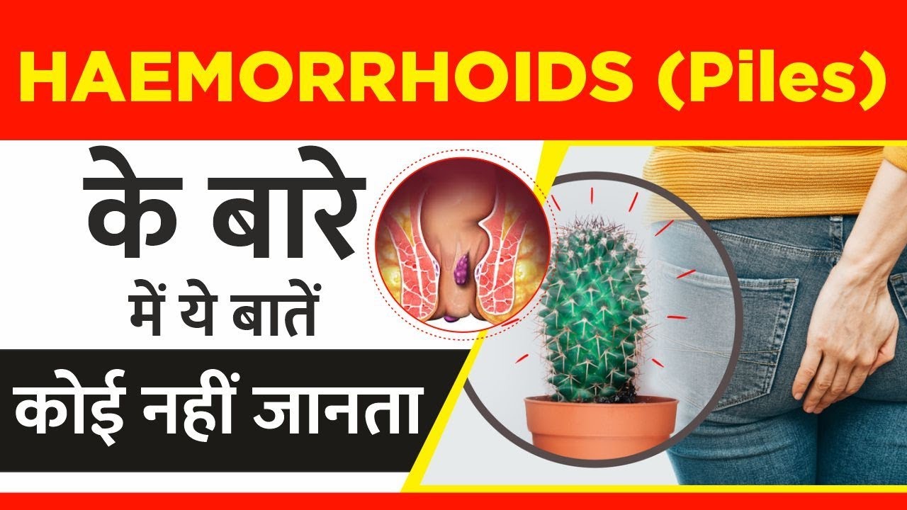 Haemorrhoid (Piles) signs & symptoms | Internal vs External | बवासीर ...