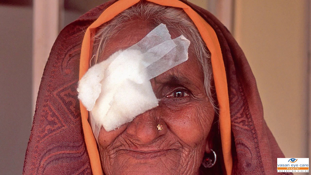 Dr. Shibu Varkey interaction with Dr Mary Evangeline about cataract ...