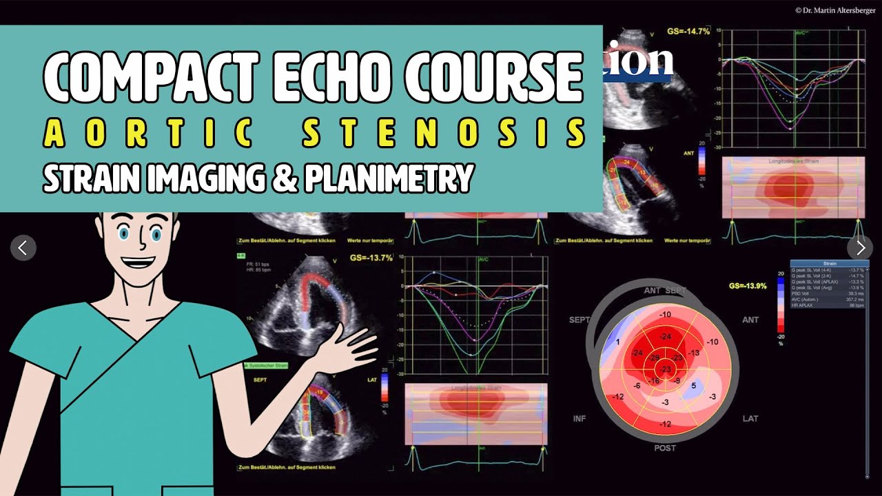 〖Echocardiography〗 Strain imaging & Planimetry in aortic stenosis ️ ...