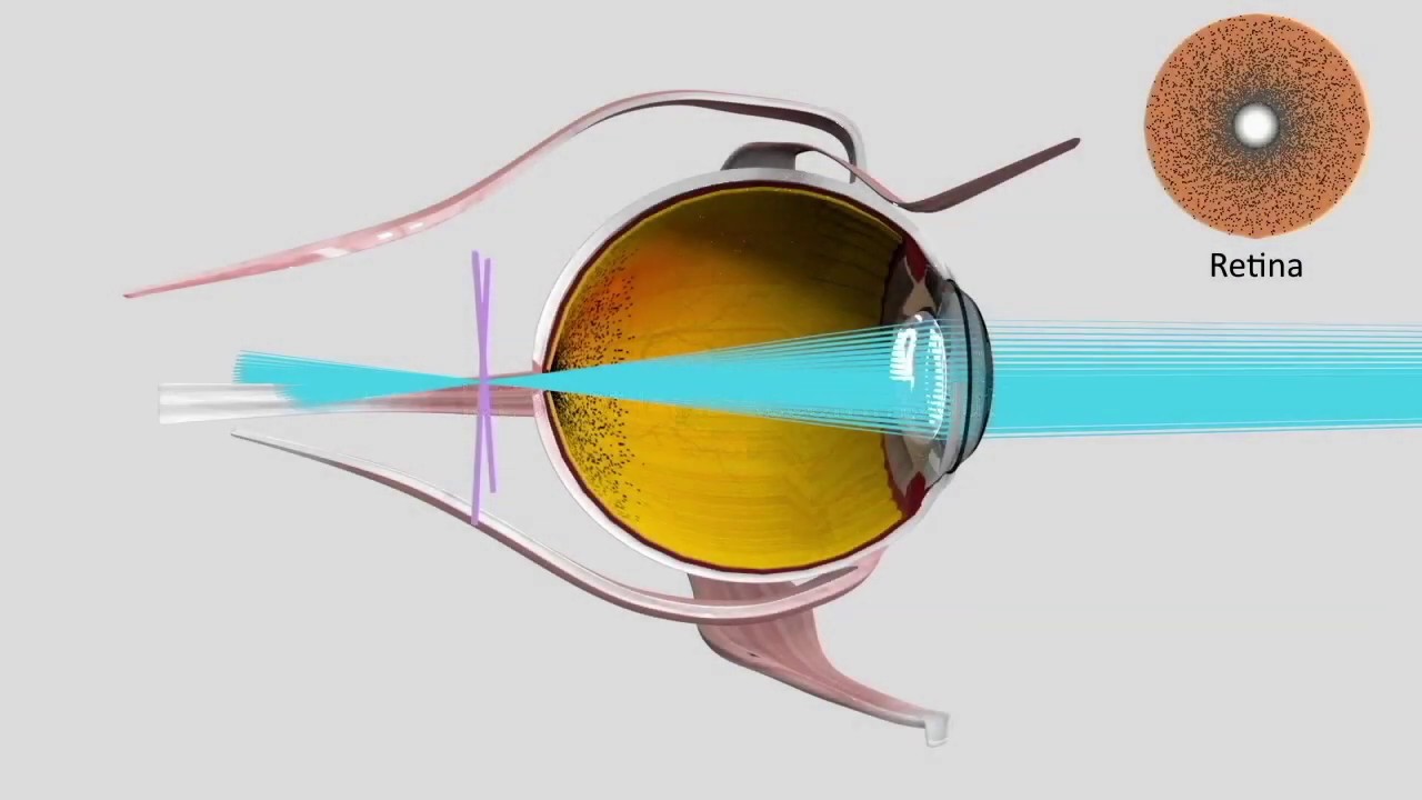 SIGGRAPH ASIA'19: Biomimetic Eye Modeling & Deep Neuromuscular ...
