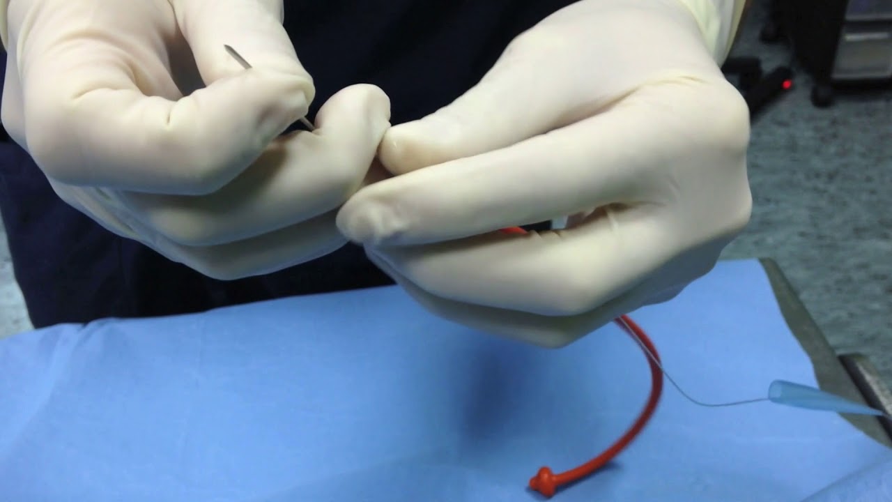 Gastrostomy Tube with Eld Applicator - YouTube