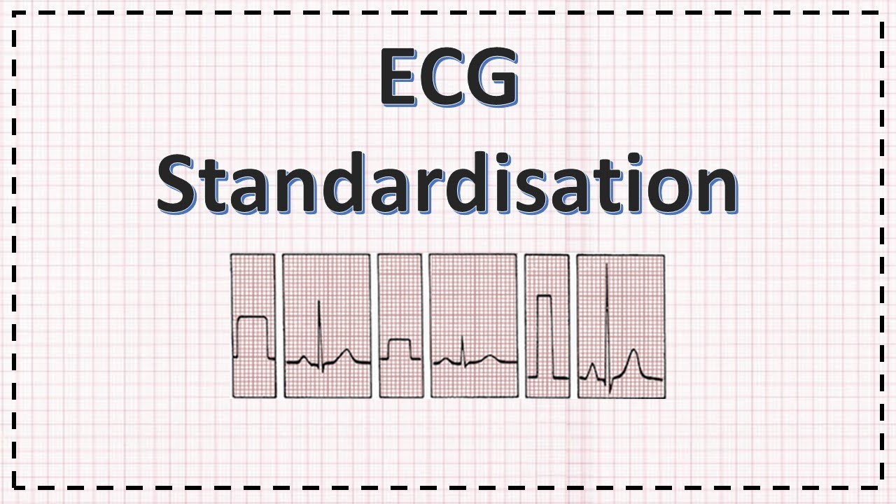 ECG Paper And Standardisation ECG Interpretation Basics Simplified