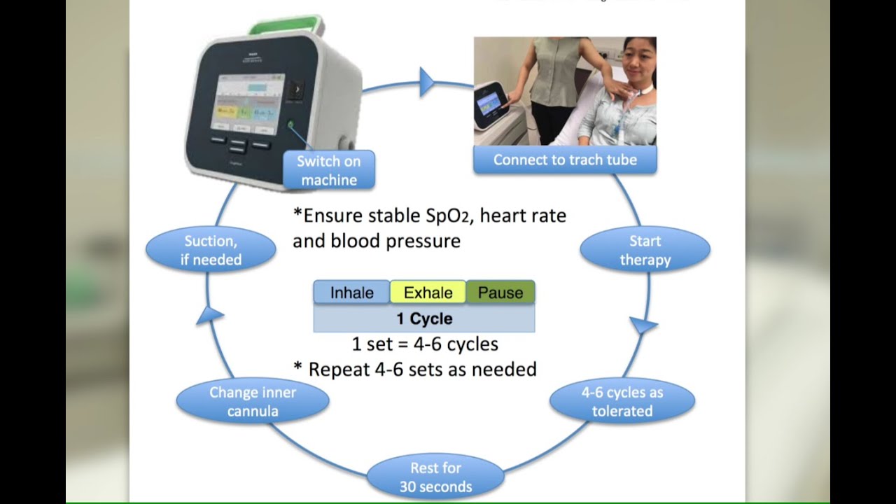 HVRSS 11. Cough Assist/ MIE (Mechanical Insufflation-Exsufflation ...