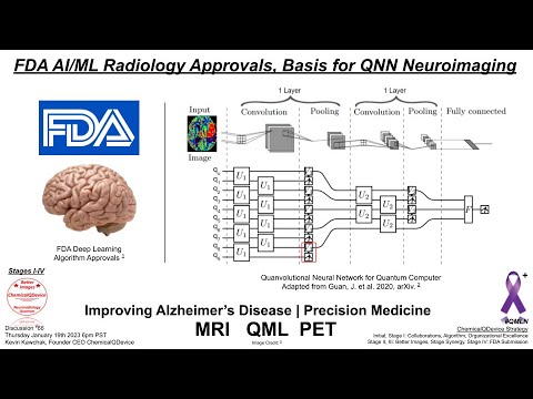 FDA AI/ML Radiology Approvals, Basis for QNN Neuroimaging - YouTube