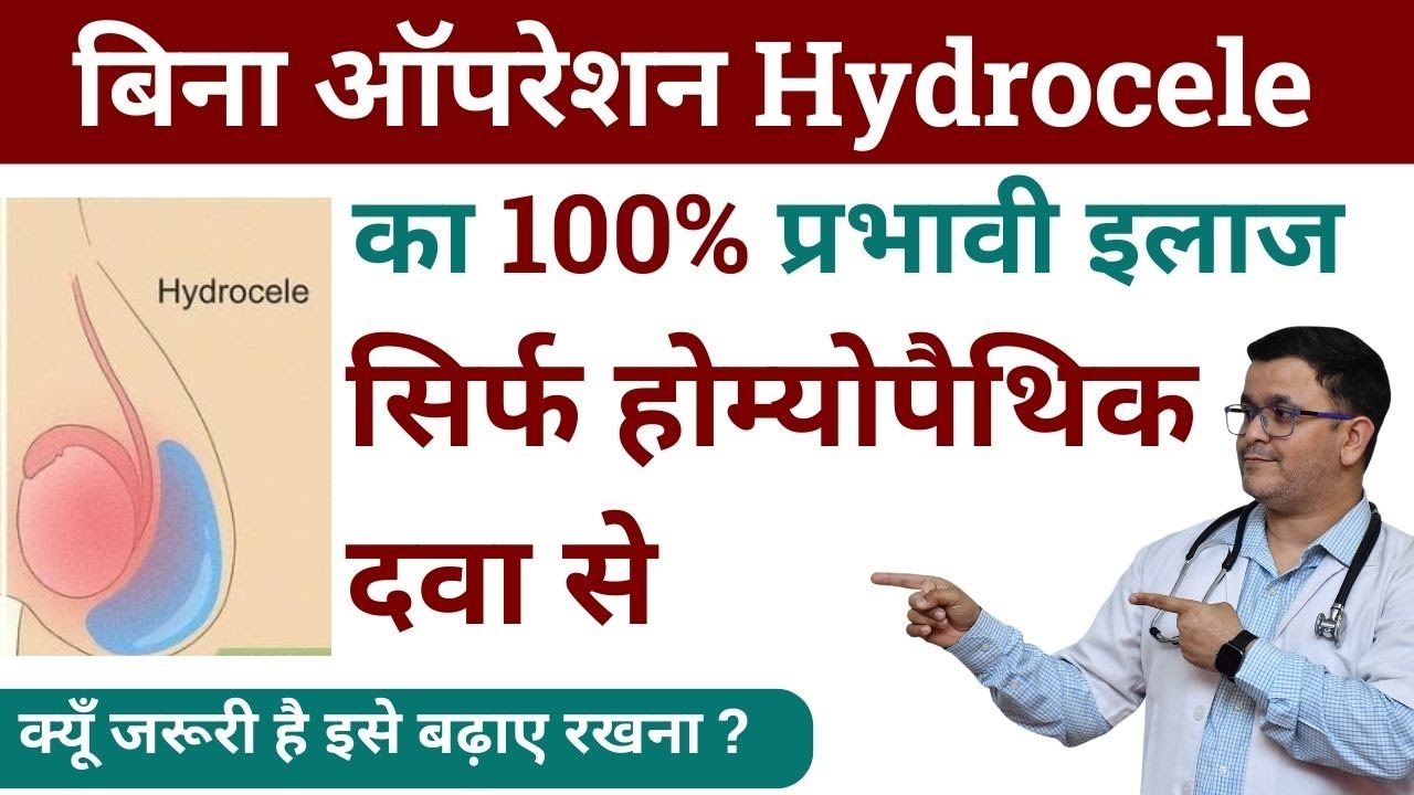 हाइड्रोसील ठीक करें बिना सर्जरी के Hydrocele ka homeopathic treatment ...