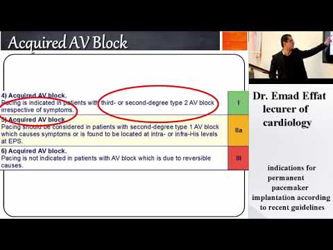 Indications of PPM implantation according to recent guidelines, Dr ...