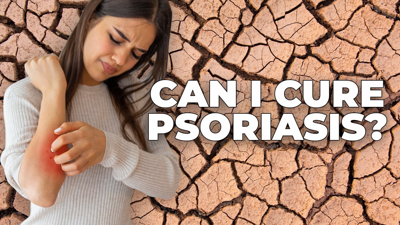 Psoriasis, Everything You Need To Know | The TMI Show - YouTube