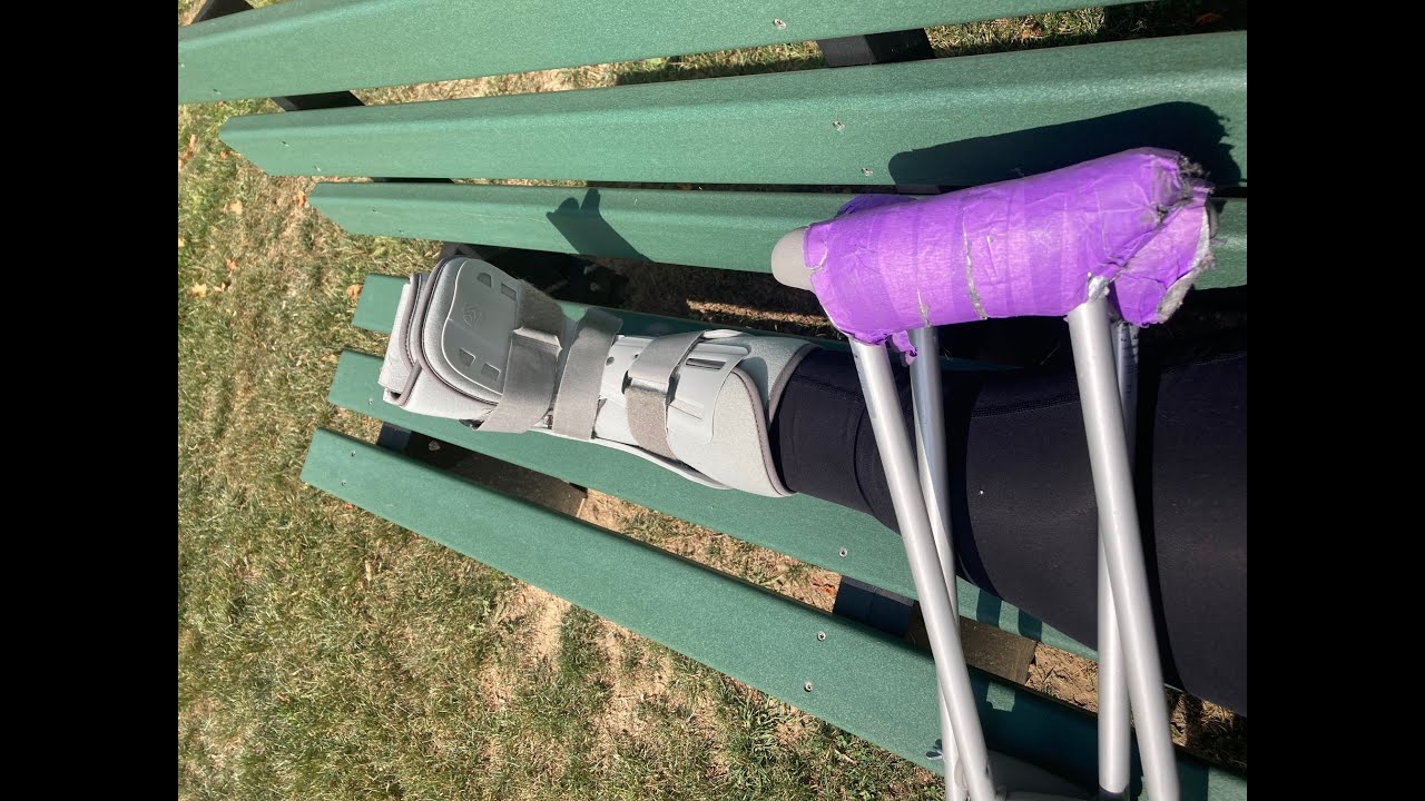 weeks 7 & 8 progress after mid-foot fusion & bone graft - YouTube