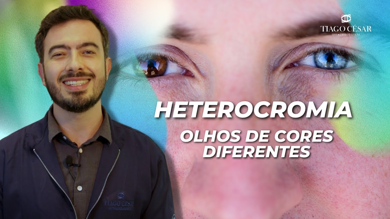 HETEROCROMIA: Olhos de Cores Diferentes | Dr. Tiago César - YouTube