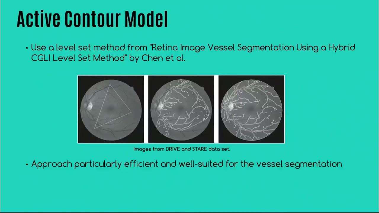 Weakly-Supervised Convolutional Neural Networks for Vessel Segmentation in Cerebral Angiography ...
